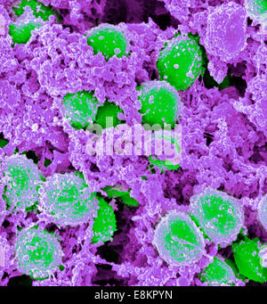 Scanning electromicrograph of Staphylococcus aureus bacteria Stock ...