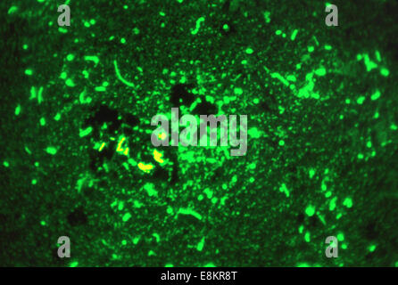 This fluorescent acid-fast stained (Smithwick) photomicrograph revealed presence of ...