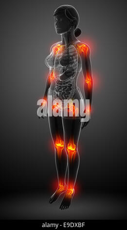 Foot pain, conceptual illustration Stock Photo - Alamy