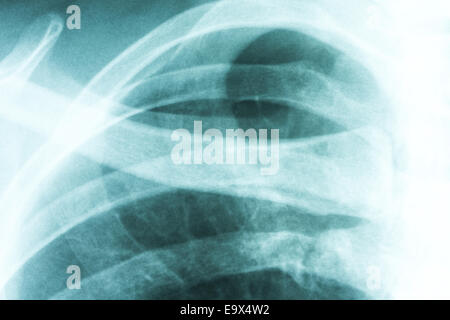 Collar bone xray. Human anatomy skeletal system. 3D illustration Stock ...