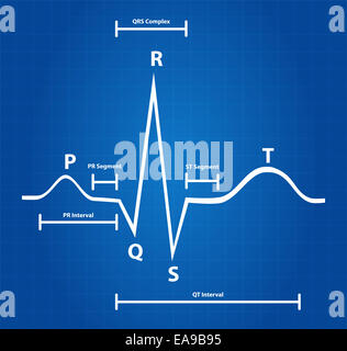 Blueprint Of Normal Electrocardiogram Graphic Stock Photo - Alamy
