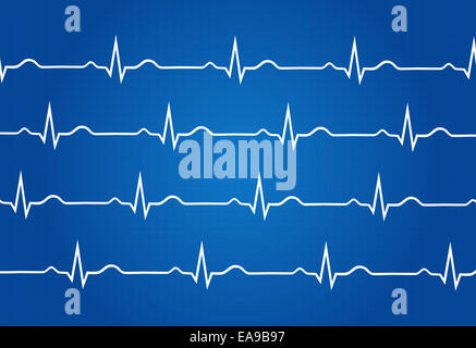 Blueprint Of Normal Electrocardiogram Graphic Stock Photo - Alamy