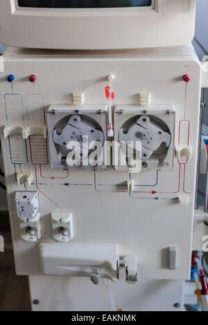 Screen monitor of a kidney dialysis (haemodialysis) machine showing the ...