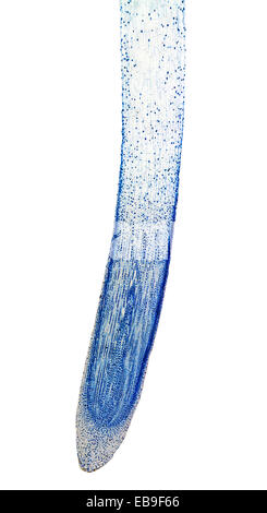 Plant cell mitosis. Light micrograph of a root tip cells squash ...