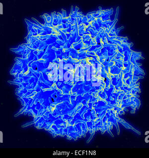 scanning electron microscope image of a blood clot showing red cells ...