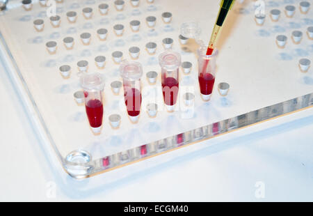 In medical laboratories studied blood. Microtube with blood located in ...