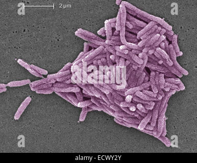 Scanning electron micrograph of Legionella bacteria Stock Photo - Alamy