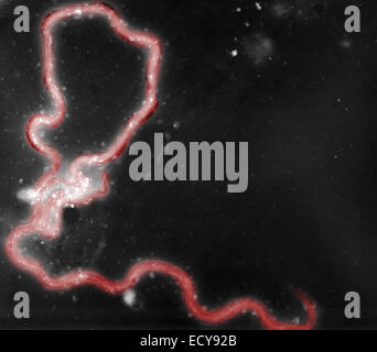 Treponema pallidum shown under dark field light microscopy Stock Photo ...