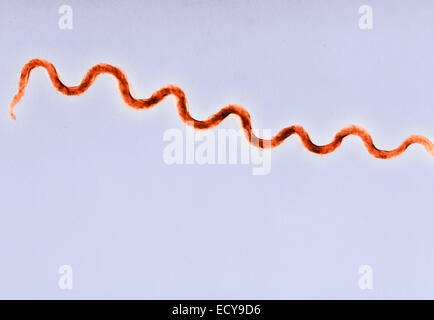 Treponema pallidum shown under dark field light microscopy Stock Photo ...