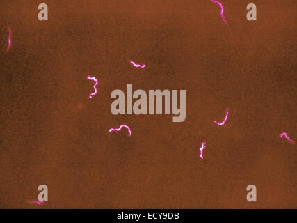 Treponema pallidum shown under dark field light microscopy Stock Photo ...