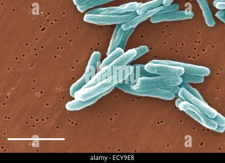 Scanning electron micrograph of Mycobacterium tuberculosis particles ...