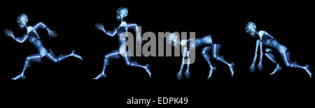 Collection of human skeleton (X-ray whole body : skull head face neck ...