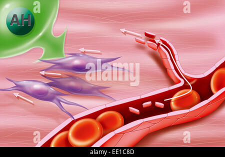 WOUND HEALING, ILLUSTRATION Stock Photo - Alamy