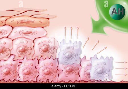 WOUND HEALING, ILLUSTRATION Stock Photo - Alamy