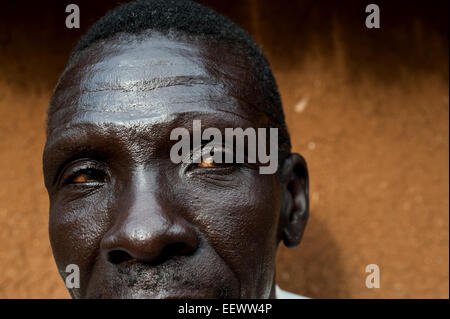 Nuer Tribe Man With Gaar Facial Markings, Gambela, Ethiopia Stock Photo ...