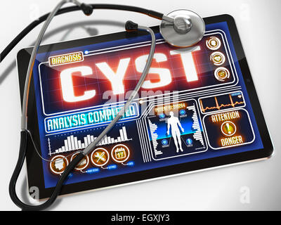Ovarian Cyst on the Display of Medical Tablet Stock Photo - Alamy