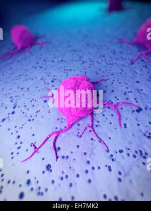 Computer artwork of cancer cells Stock Photo - Alamy