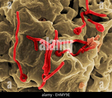 Ebola virus. Coloured scanning electron micrograph (SEM) of Ebola virus ...
