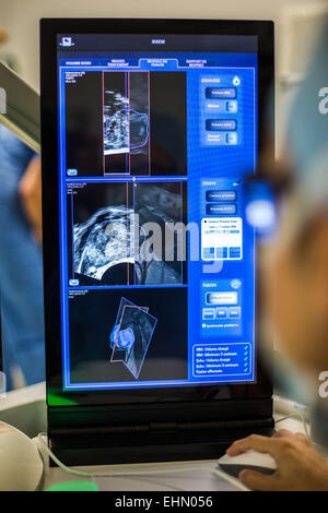Treatment of prostatic cancer by high intensity focus ultrasound (Focal ...