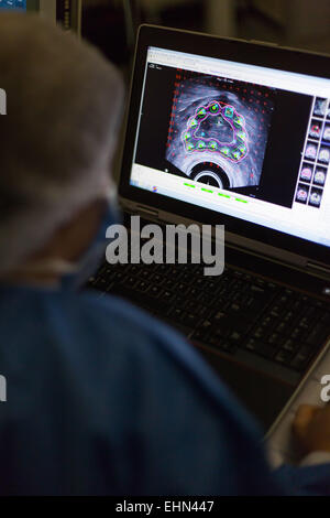 Prostate cancer radiotherapy surgery. Radiologist positioning a trans ...