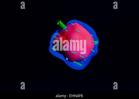 Prostate cancer radiotherapy surgery. Radiologist inserting a hollow ...