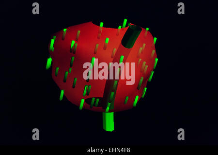 Prostate cancer radiotherapy surgery. Radiologist inserting a hollow ...