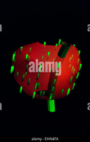 Prostate cancer radiotherapy surgery. Radiologist inserting a hollow ...