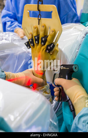 Pin placing on a broken wrist arthroscopy, Jouvenet clinic, Paris ...