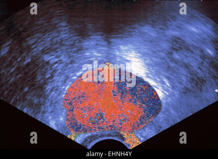 Normal male genitalia Stock Photo - Alamy