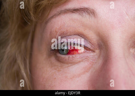 The human eye in health and disease : as seen with the ophthalmoscope ...