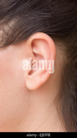 Accessory auricle. Close-up of an accessory auricle on a 2-month-old ...