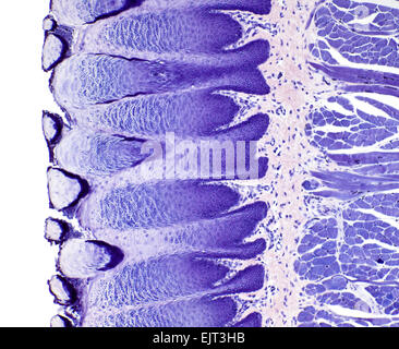 Tongue section showing taste buds, striated muscles and connective ...