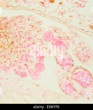Slice fern leaf under a microscope, (Fern Leaf Sec.), 400x Stock Photo ...