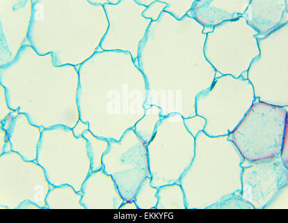 Stalk of a cereal cross-section under the microscope (Corn Stem C.S ...