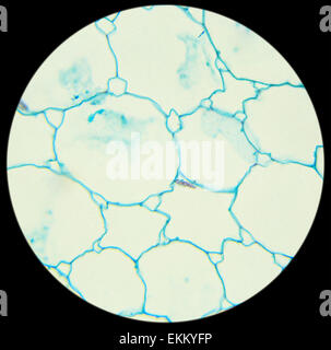 Sunflower stalk cross-section under the microscope, (Helianthus Stem C ...