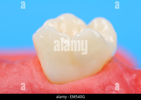 tooth in the gum extra close up Stock Photo - Alamy