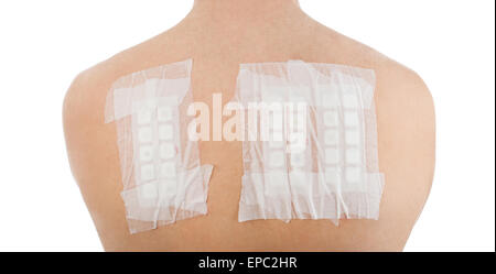 Allergy patch test Stock Photo - Alamy