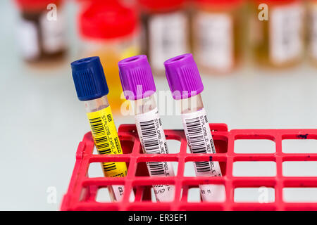 Analysis of lead in the blood (lead poisoning). Laboratory of ...