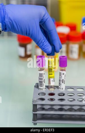 Analysis of lead in the blood (lead poisoning). Laboratory of ...