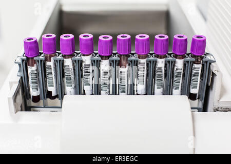 Medical analysis laboratory. Blood test. Medical analysis laboratory ...