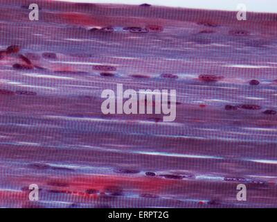 Skeletal muscle tissue longitudinal section under a microscope Stock ...