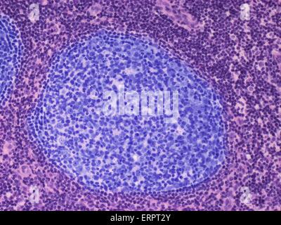 Lymph node. Coloured light micrograph of a section through a lymph node ...