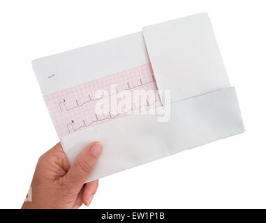 ECG printout isolated on white background Stock Photo - Alamy