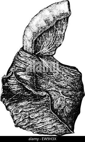vector illustration of intussusception of intestine. obstruction Stock ...