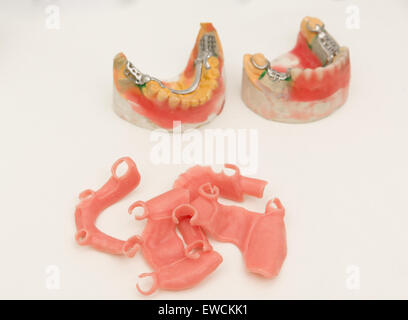 denture clasp on one of the stages of manufacturing in the dental ...