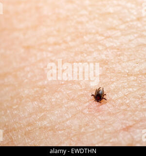 Small tick insect with head buried in human skin. Disease risk Stock ...
