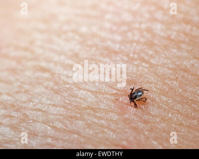 Small tick insect with head buried in human skin. Disease risk Stock ...