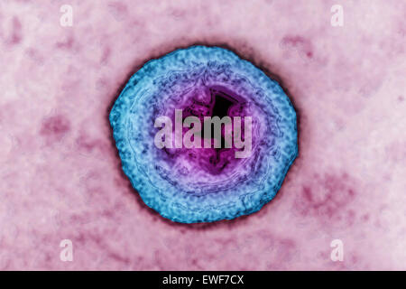 HERPES SIMPLEX VIRUS Stock Photo - Alamy