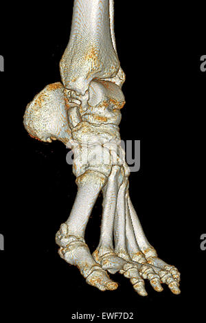 LOWER LIMB, 3D SCAN Stock Photo - Alamy