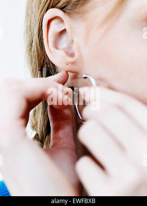 Close up of contact dermatitis or skin allergy due to wearing a leather ...